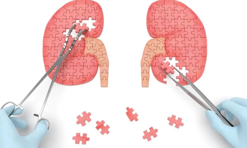 Calcul rénal : combien de jours d’hospitalisation