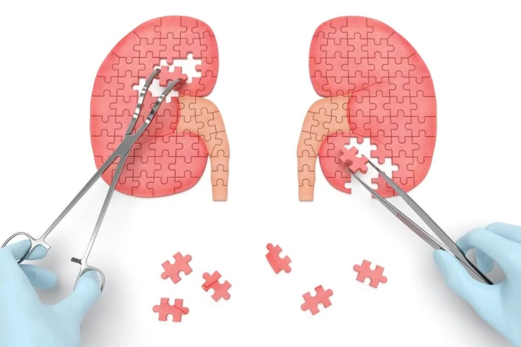 Débord Discal : Comprendre cette Pathologie Vertébrale